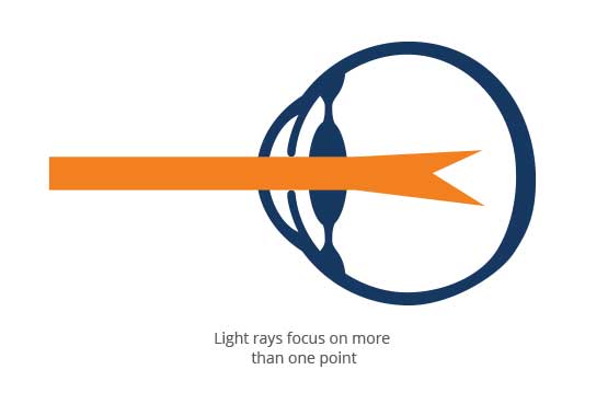 Pupillary Distance – Mad About Specs - Glasses Online